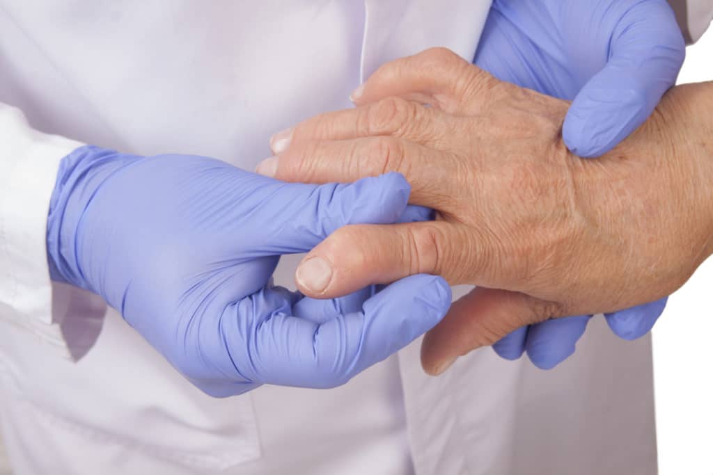 Rheumatologists Help With Arthritis and Diseases of the Joints, Muscles ...